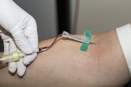 Aderlass: Was ist das? Behandlungsprinzip und Anwendungen - PhytoDoc